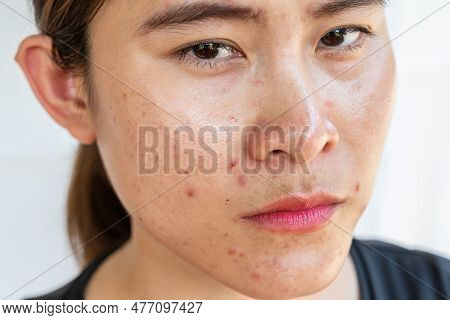 Head Shot Asian Woman Image Photo Free Trial Bigstock