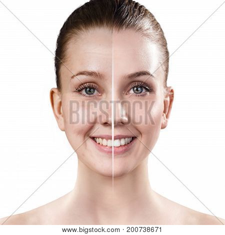 Woman's Face Before Image & Photo (Free Trial) | Bigstock
