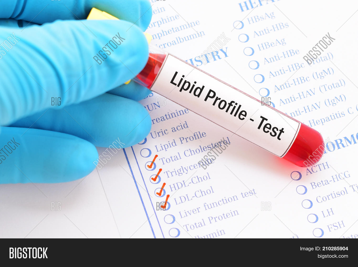 Blood Sample Image & Photo (Free Trial) | Bigstock