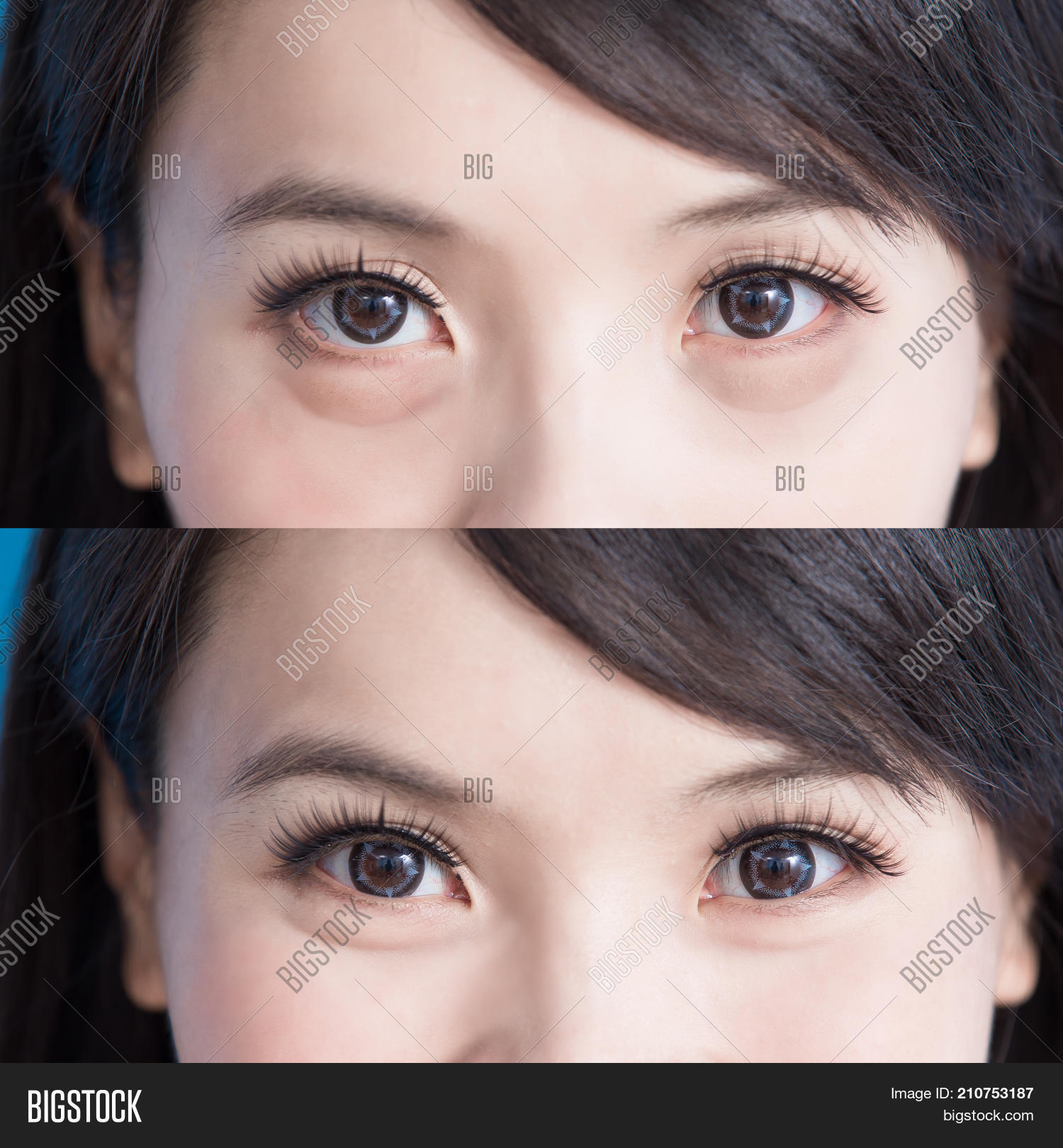 Woman Eye Bags Vefore Image & Photo (Free Trial) | Bigstock