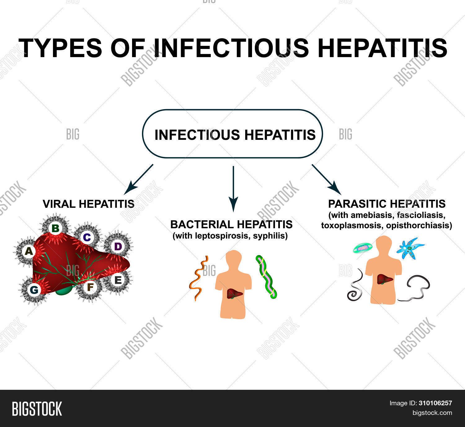 Types Viral Hepatitis Image & Photo (Free Trial) | Bigstock