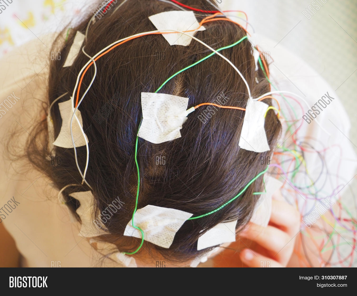 Girl Eeg Electrodes Image & Photo (Free Trial) | Bigstock
