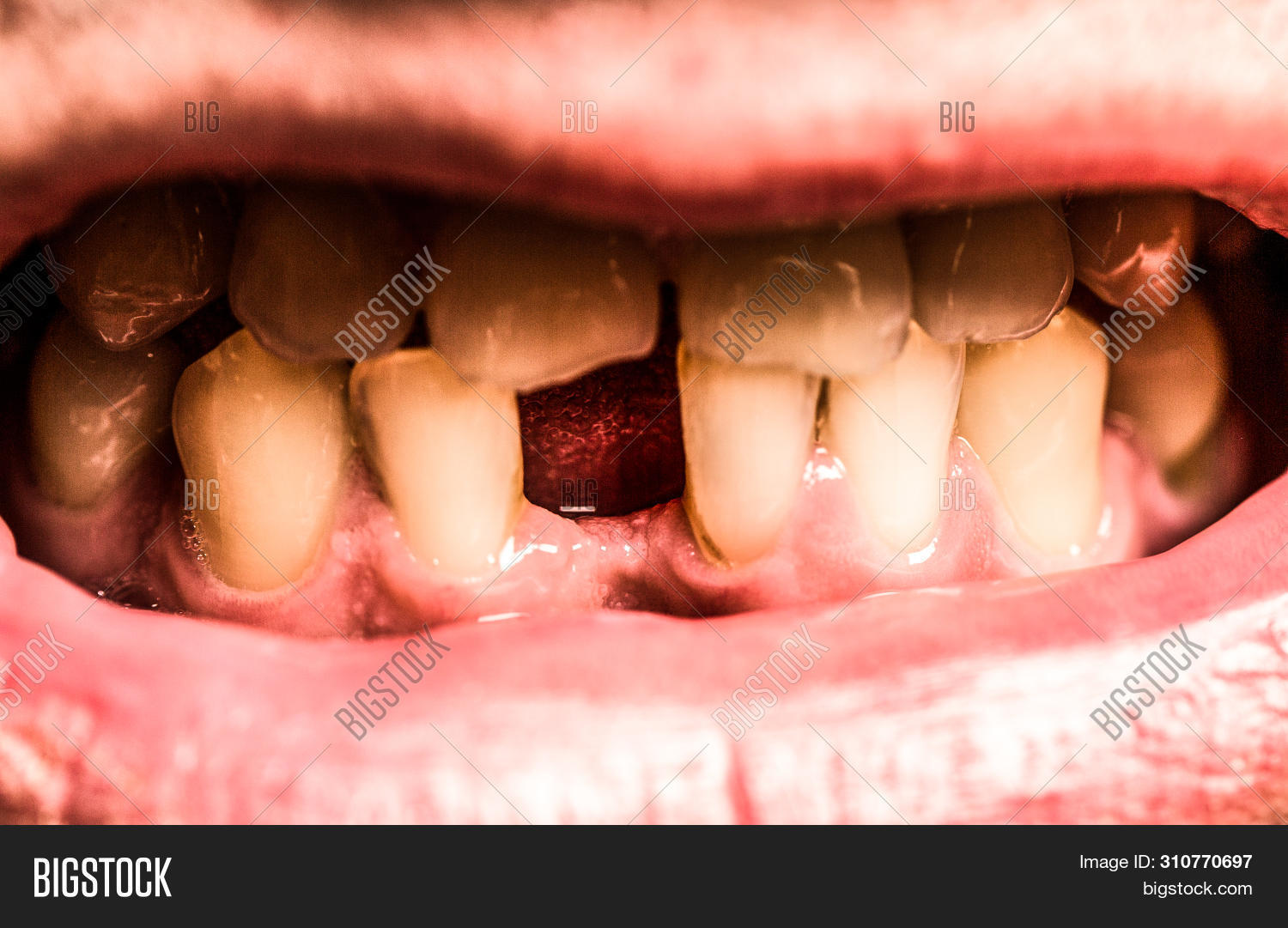 Man Without One Front Image & Photo (Free Trial) | Bigstock