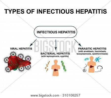 Types Viral Hepatitis Image & Photo (Free Trial) | Bigstock
