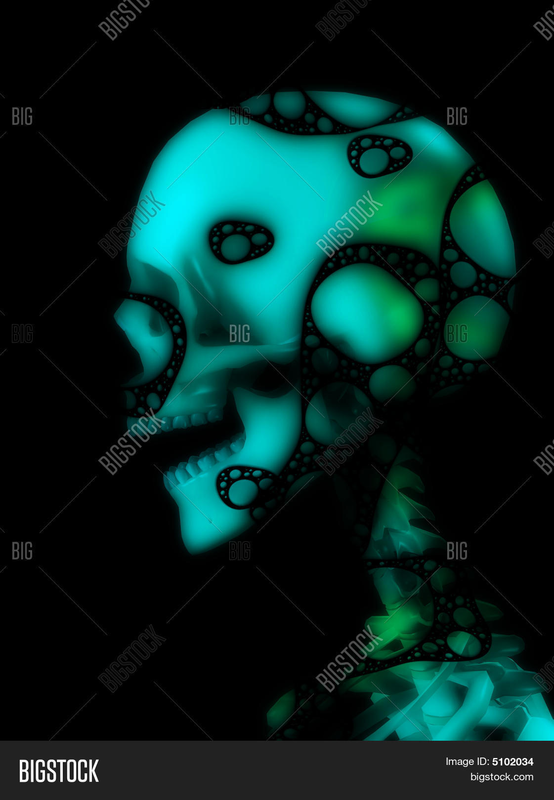 Death Disease Image & Photo (Free Trial) | Bigstock