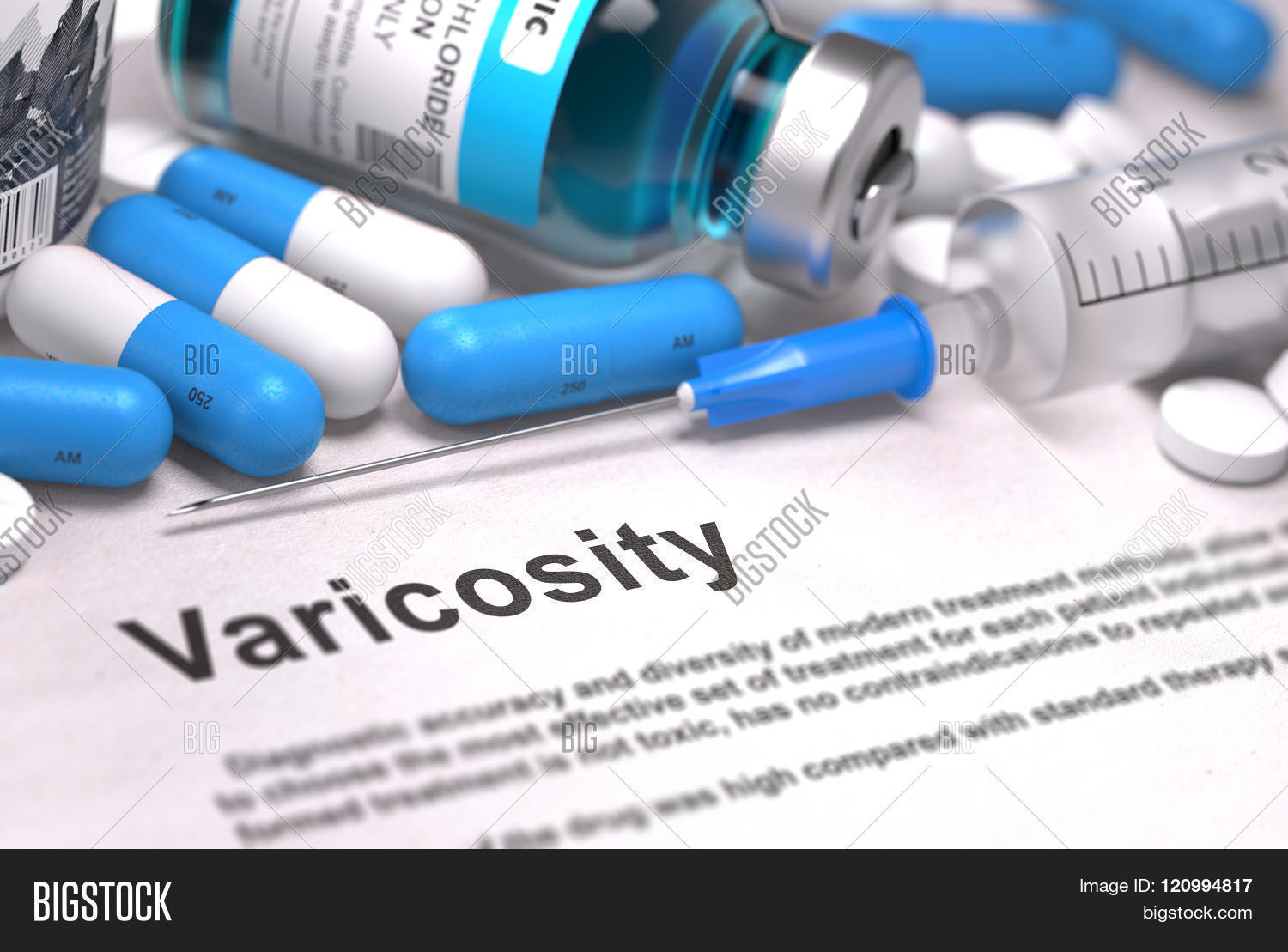 Diagnosis - Varicosity Image & Photo (Free Trial) | Bigstock