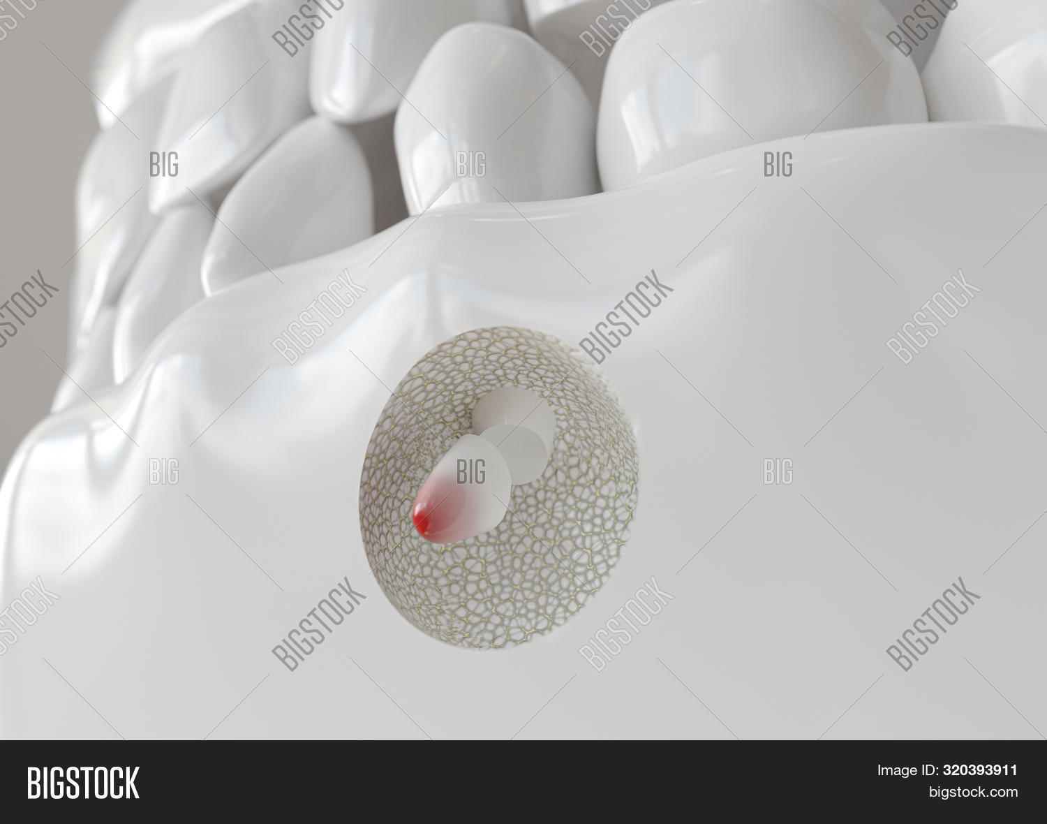 Root Tip Inflammation Image & Photo (Free Trial) | Bigstock