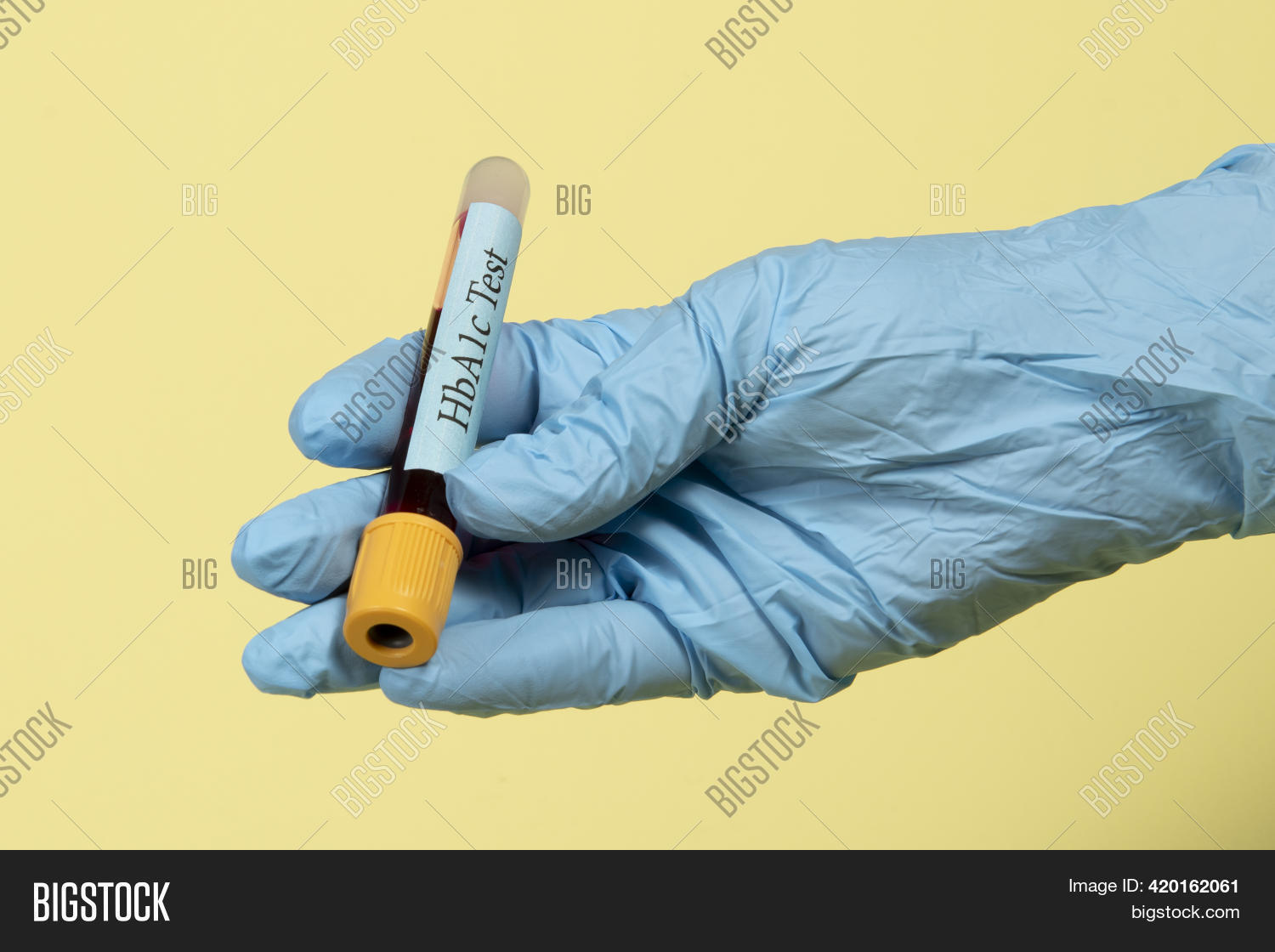 Blood Sample Vacuum Image & Photo (Free Trial) | Bigstock