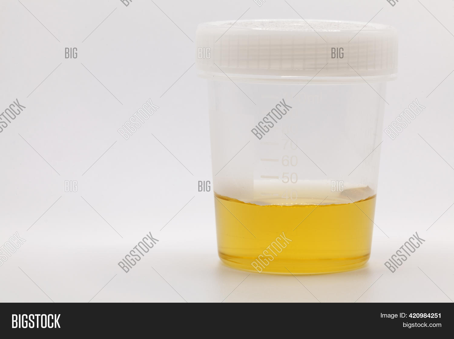 Canned Urine Sample On Image & Photo (Free Trial) | Bigstock