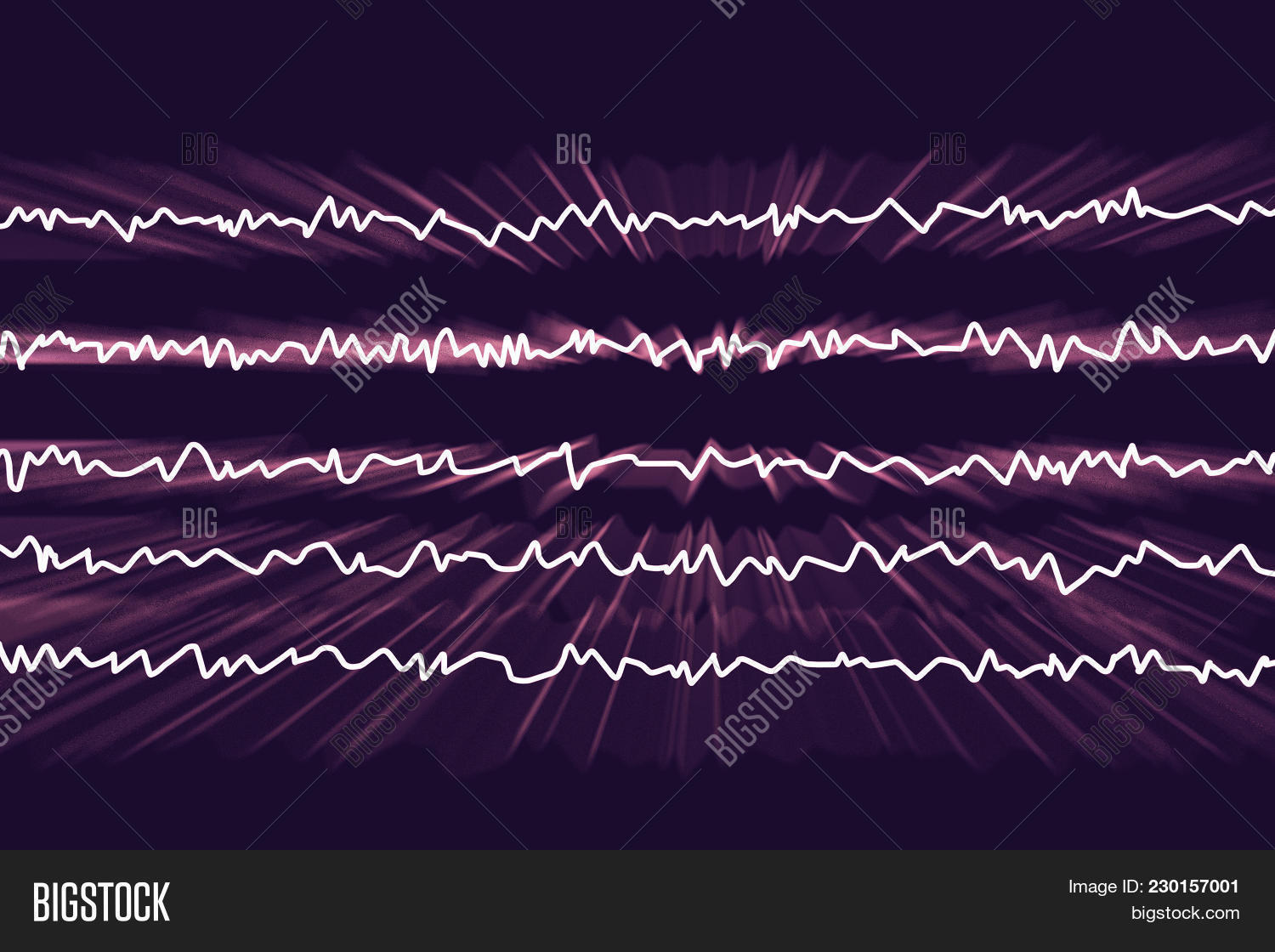 Eeg Image & Photo (Free Trial) | Bigstock