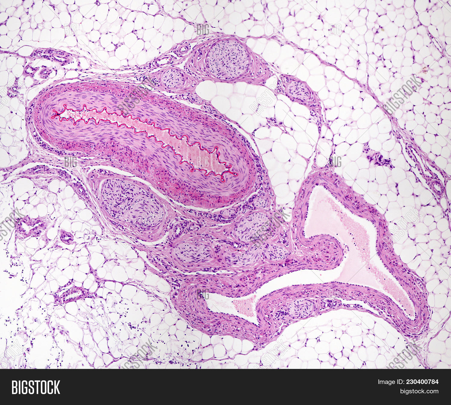 Muscular Artery, Vein Image & Photo (Free Trial) | Bigstock