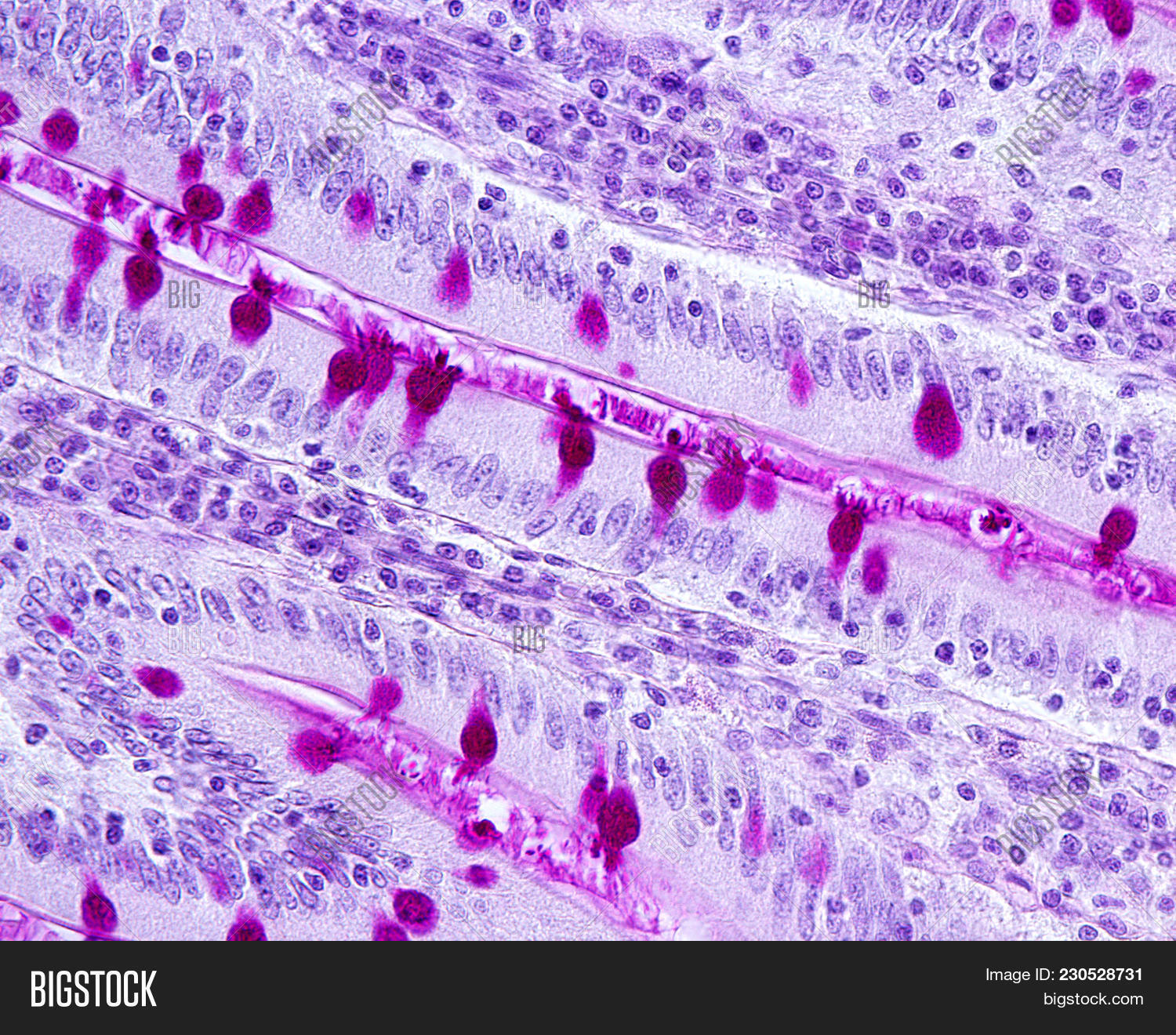 Wall Small Intestine Image & Photo (Free Trial) | Bigstock