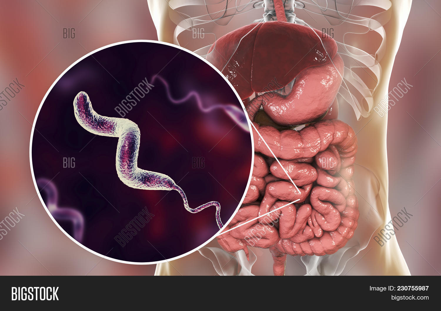 Campylobacter Bacteria Image & Photo (Free Trial) | Bigstock