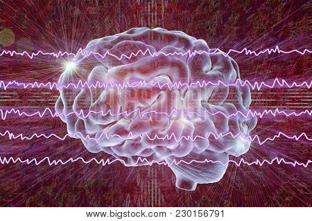 Eeg Image & Photo (Free Trial) | Bigstock