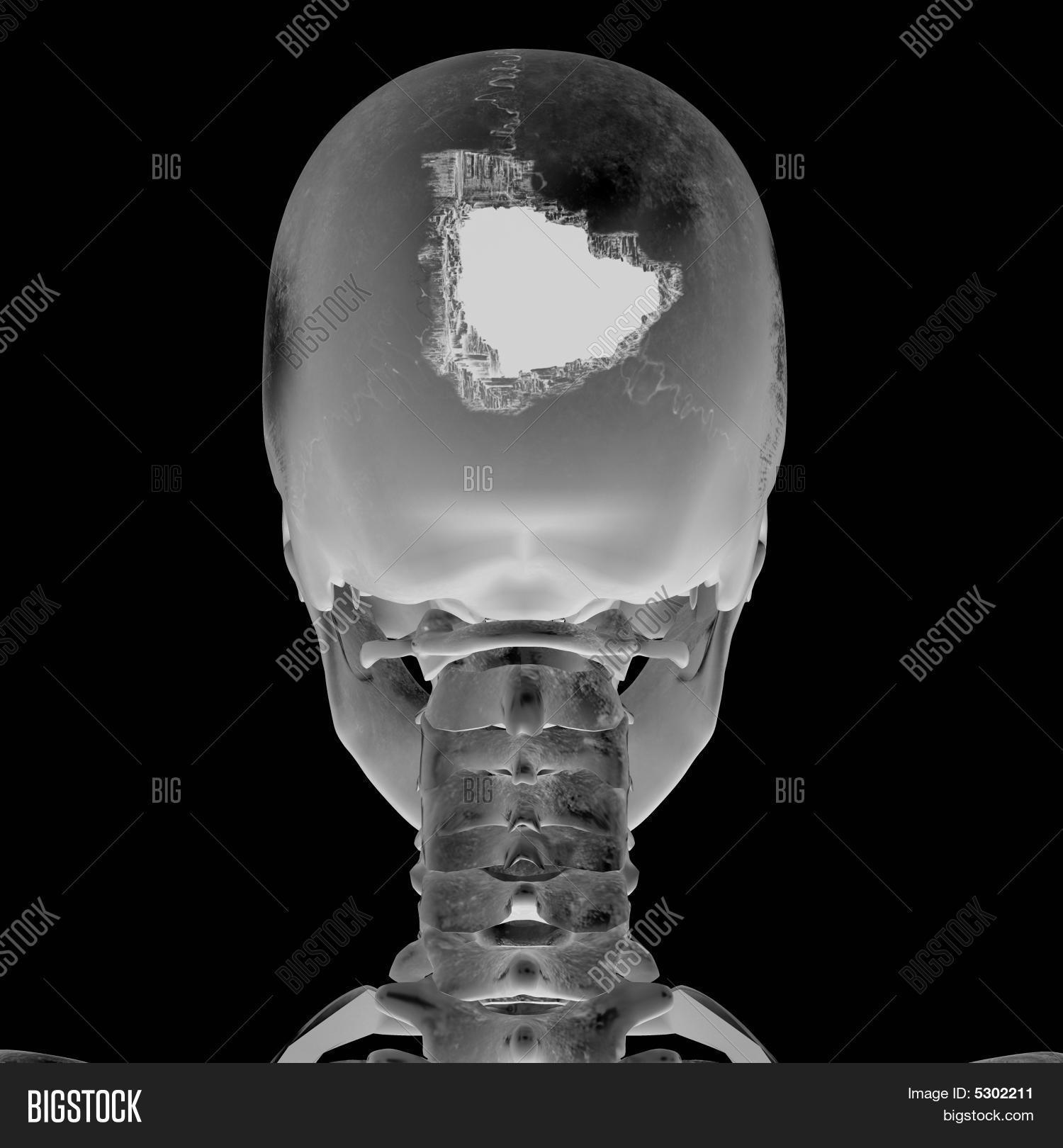 3D Radiograph Head Image & Photo (Free Trial) | Bigstock