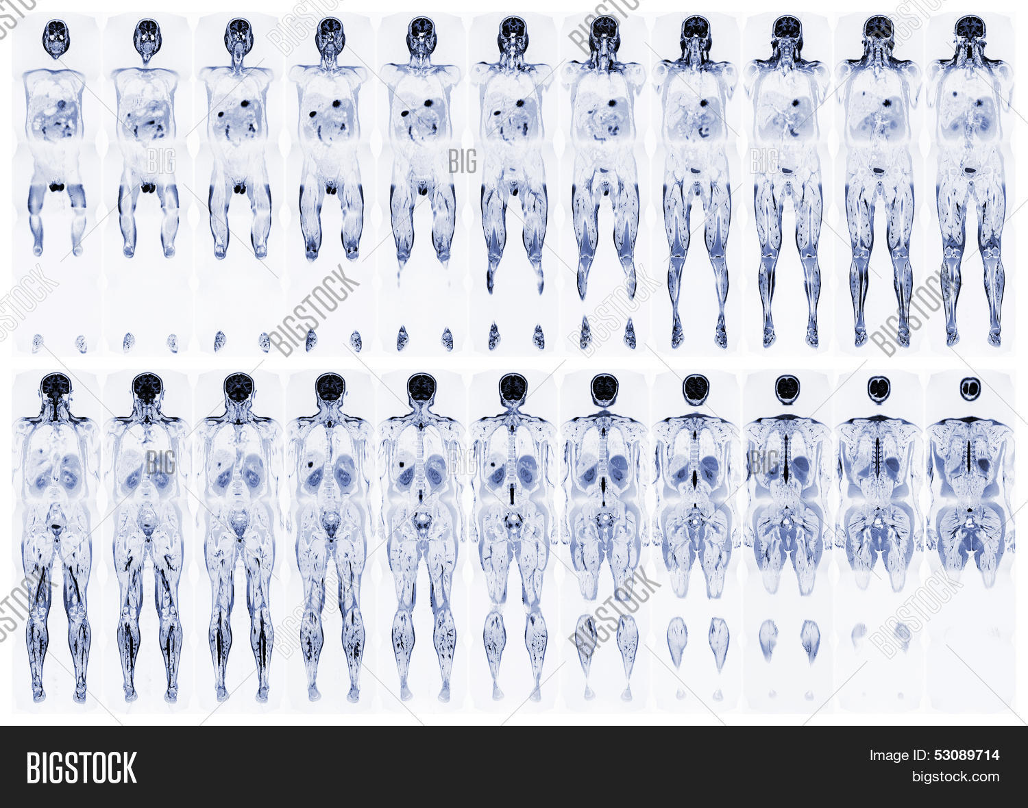 Scan Human Body Image & Photo (Free Trial) | Bigstock