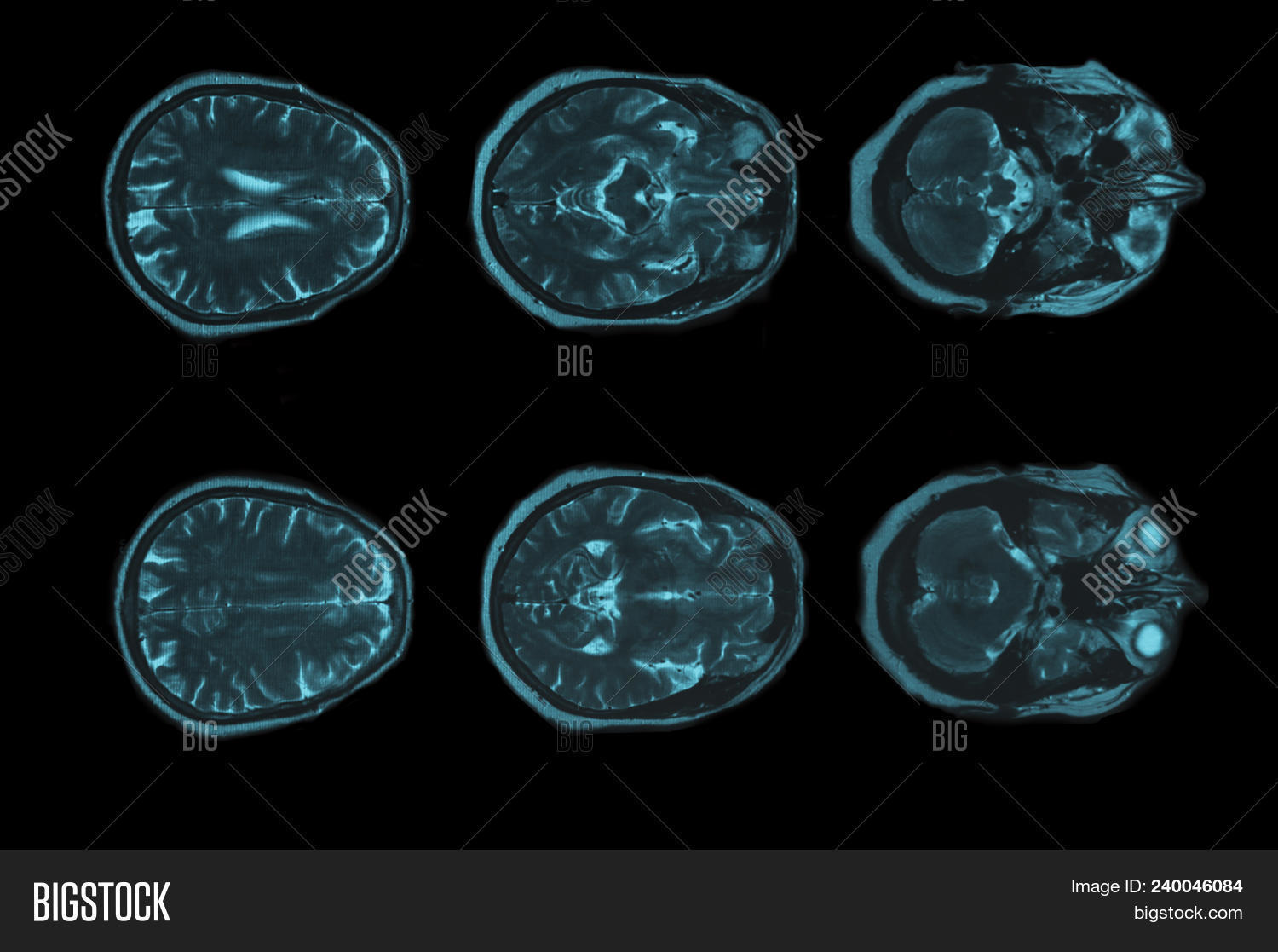 Peanut Brain X Ray at Norma Plouffe blog