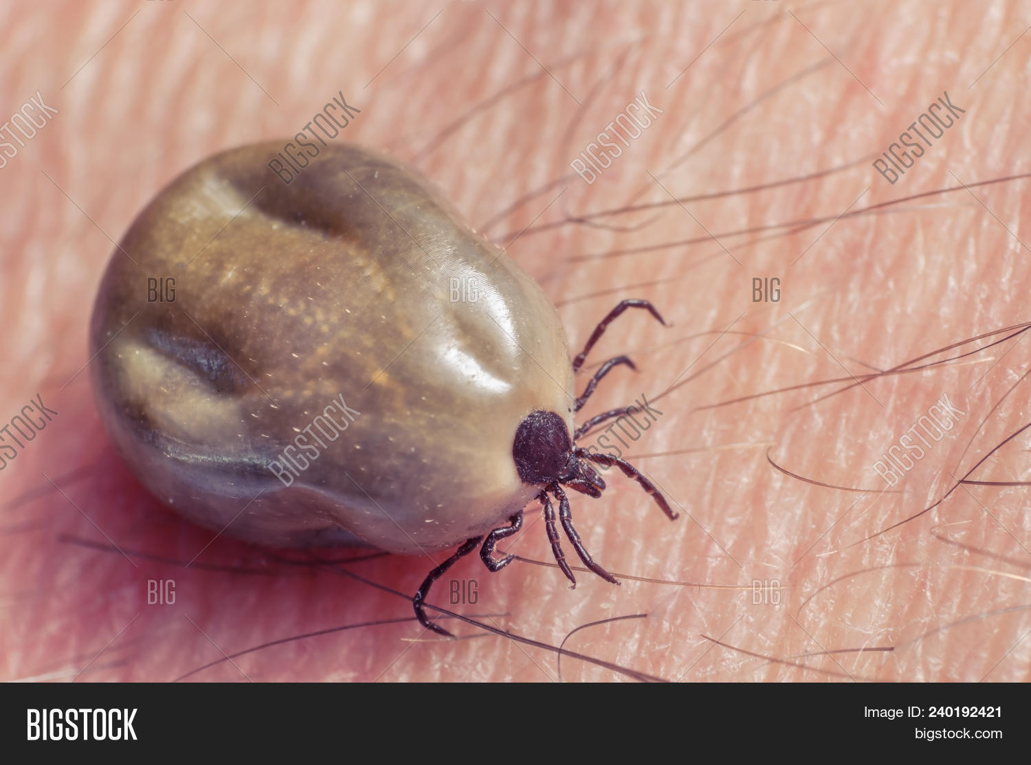 Tick Filled Blood Image & Photo (Free Trial) | Bigstock