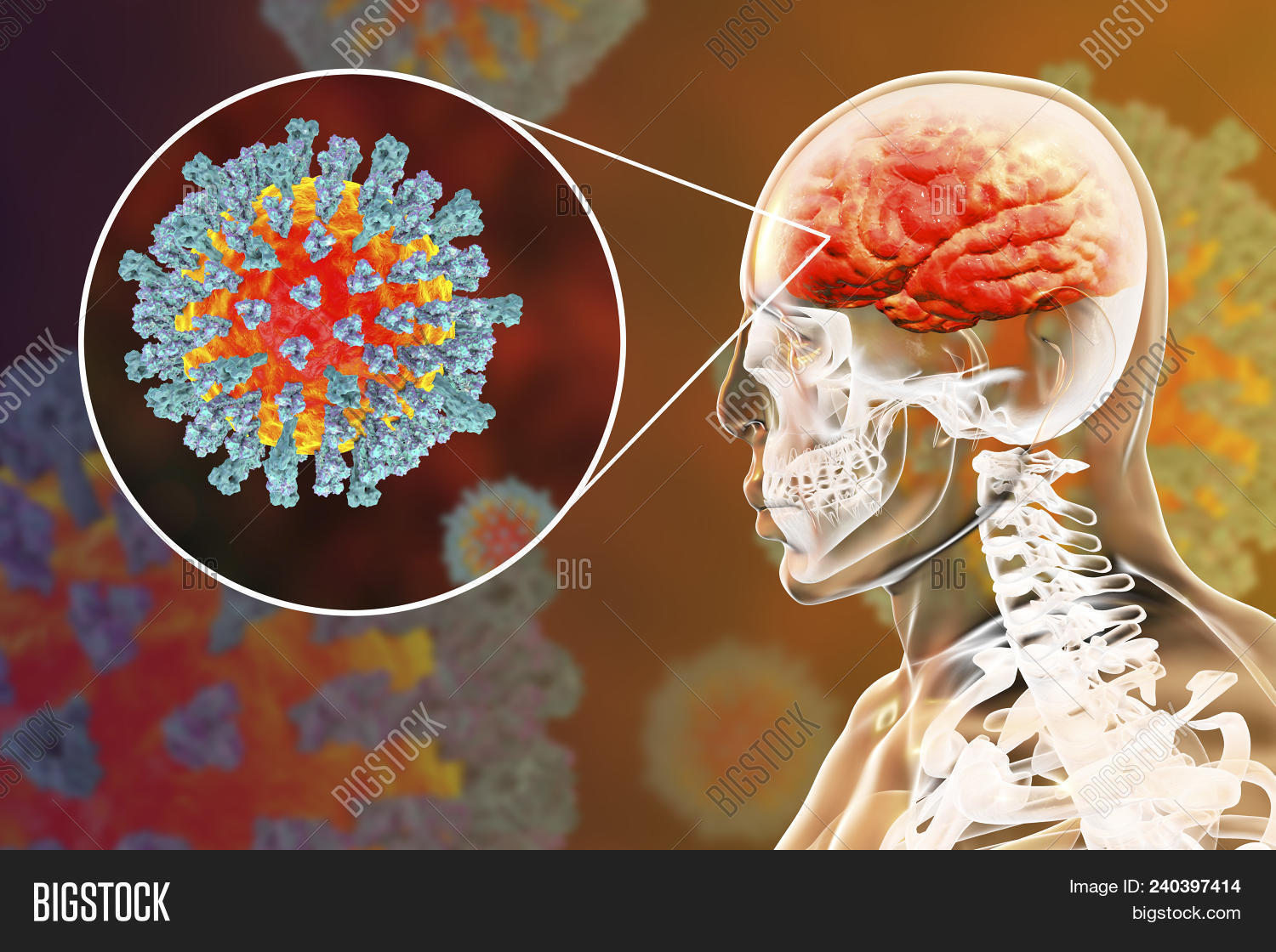 Measles-induced Image & Photo (Free Trial) | Bigstock