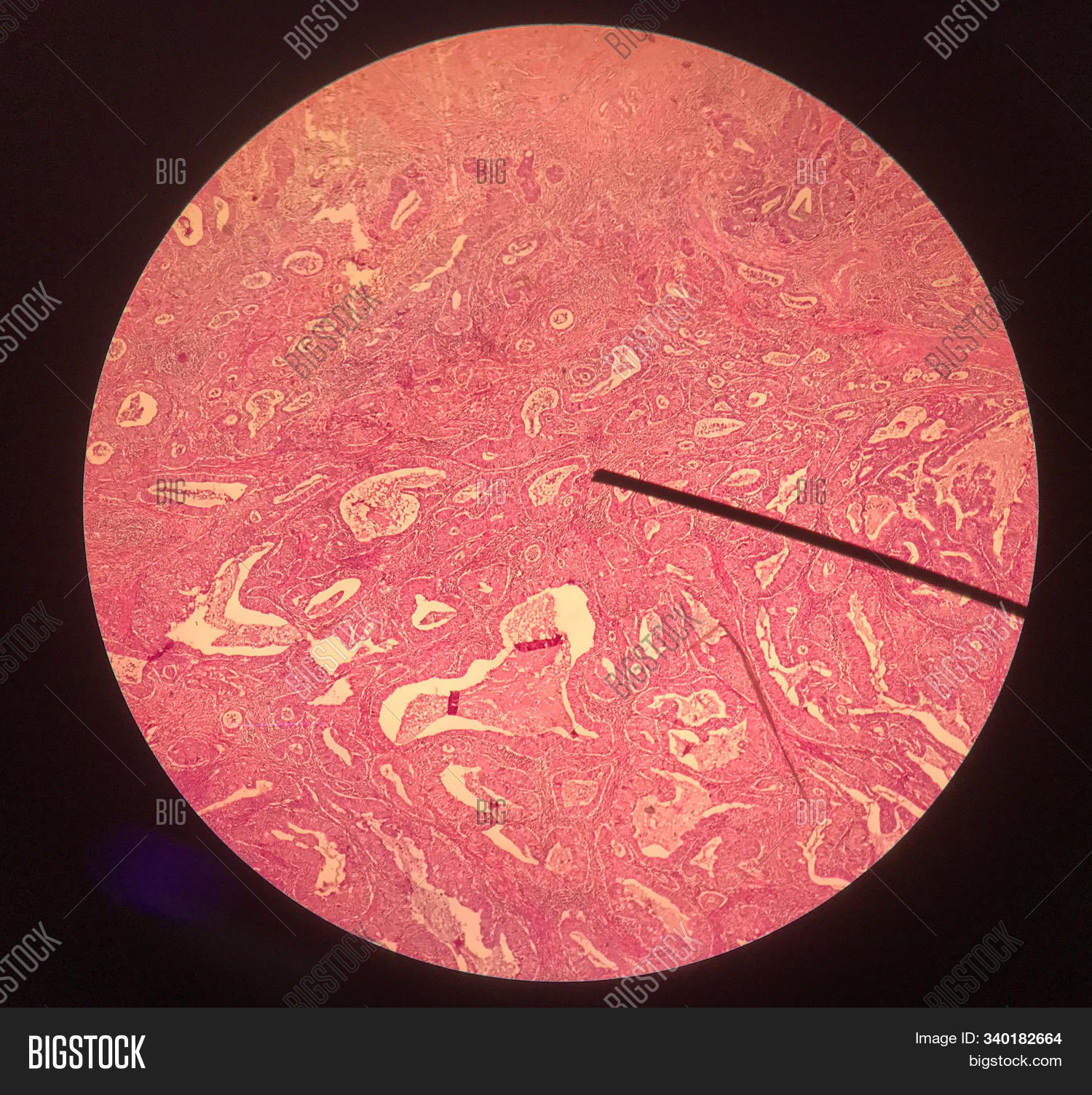 Cells Reproductive Image & Photo (Free Trial) | Bigstock