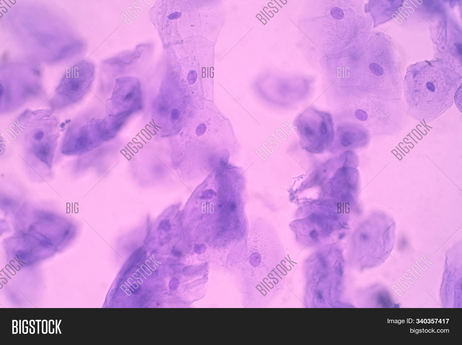 Human Cheek Epithelial Image & Photo (Free Trial) | Bigstock