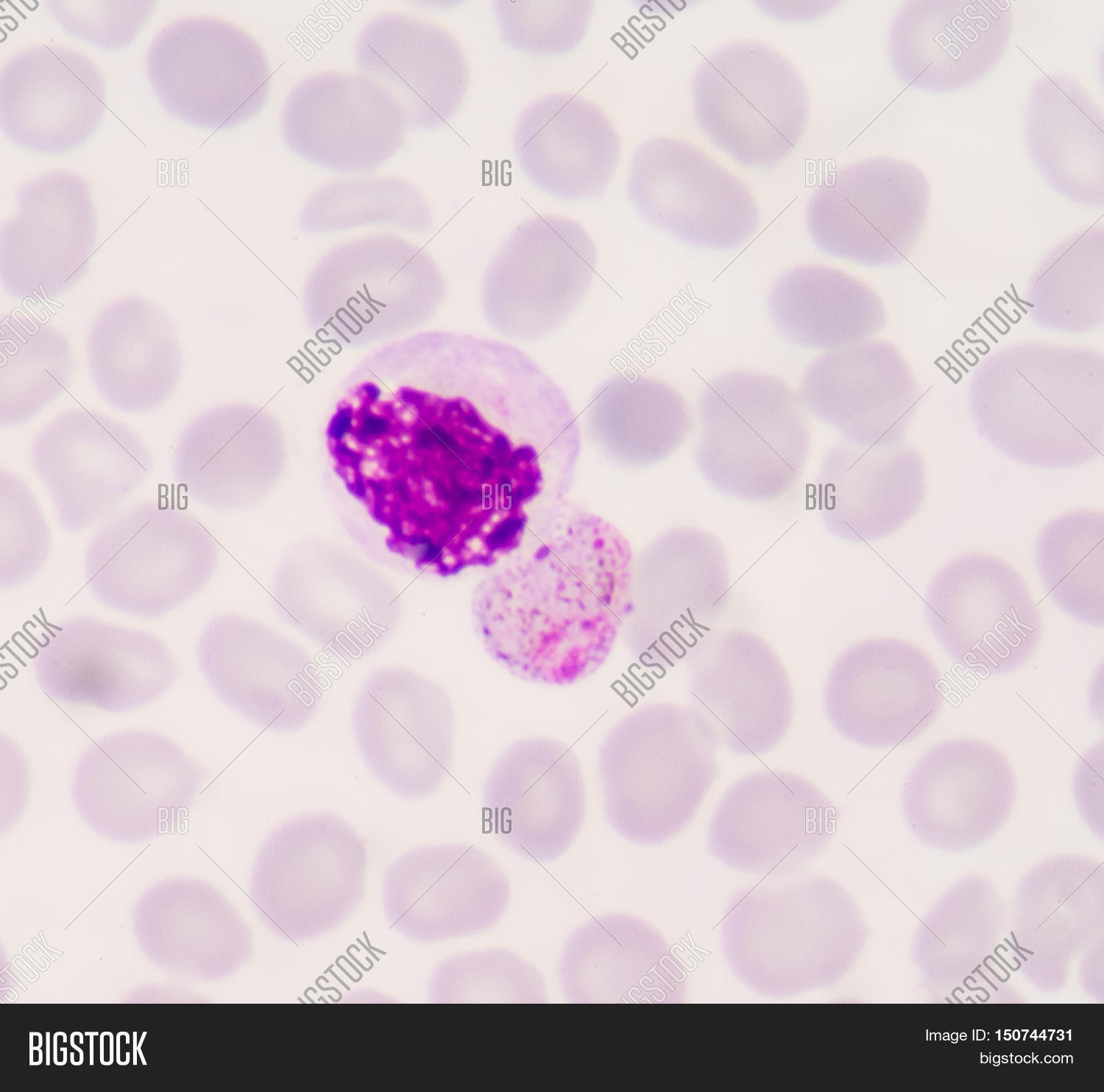 Blood Films Malaria Image & Photo (Free Trial) | Bigstock