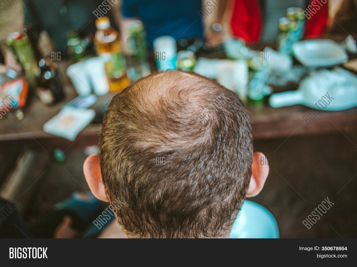 Young Man Receding Image & Photo (Free Trial) | Bigstock