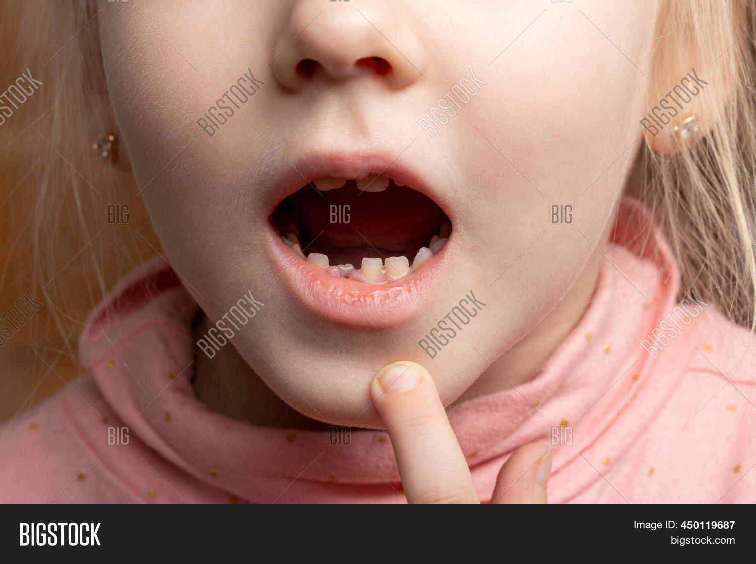 Child Open Mouth Image & Photo (Free Trial) | Bigstock