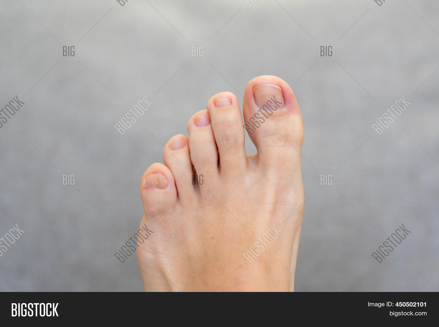 Female Feet Big Double Image & Photo (Free Trial) | Bigstock