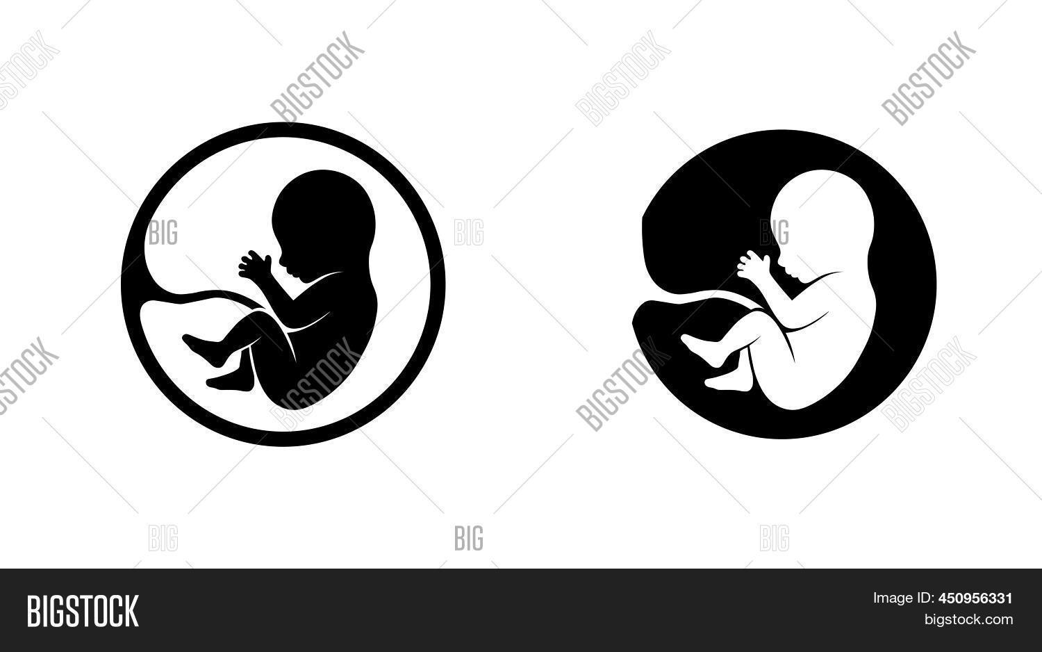 Human Embryo On White Image & Photo (Free Trial) | Bigstock