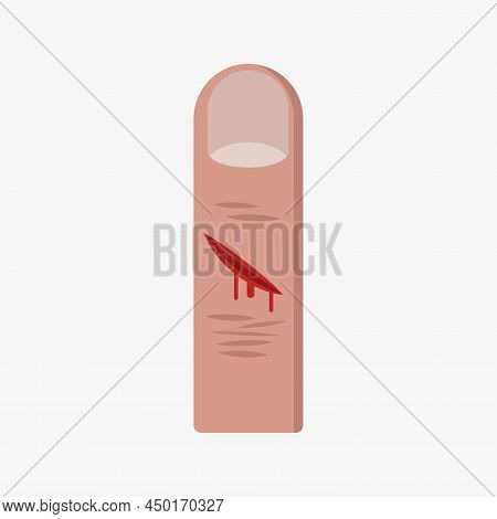 Bleeding Human Finger Vector & Photo (Free Trial) | Bigstock