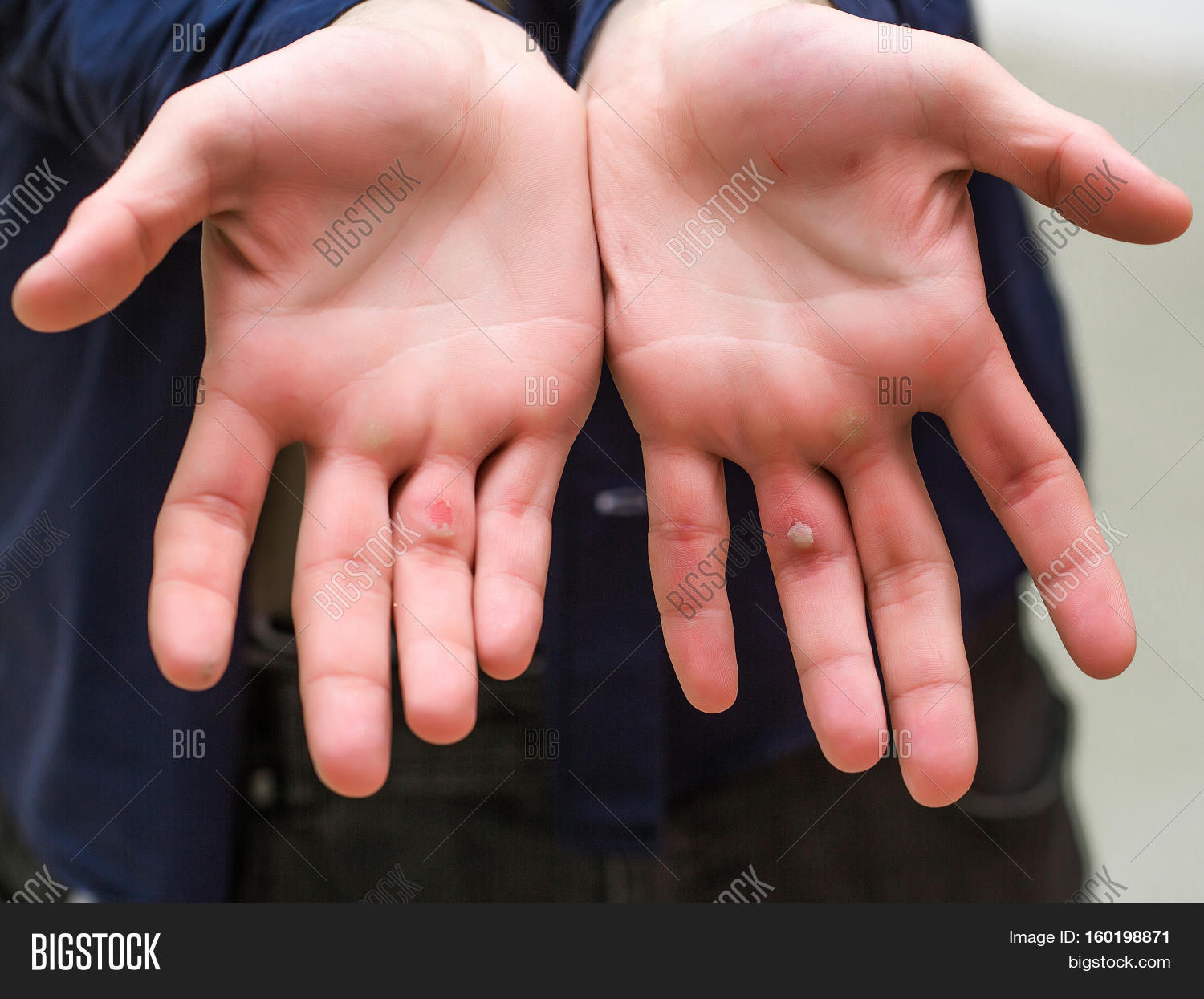 Male Hands Palms Image & Photo (Free Trial) | Bigstock