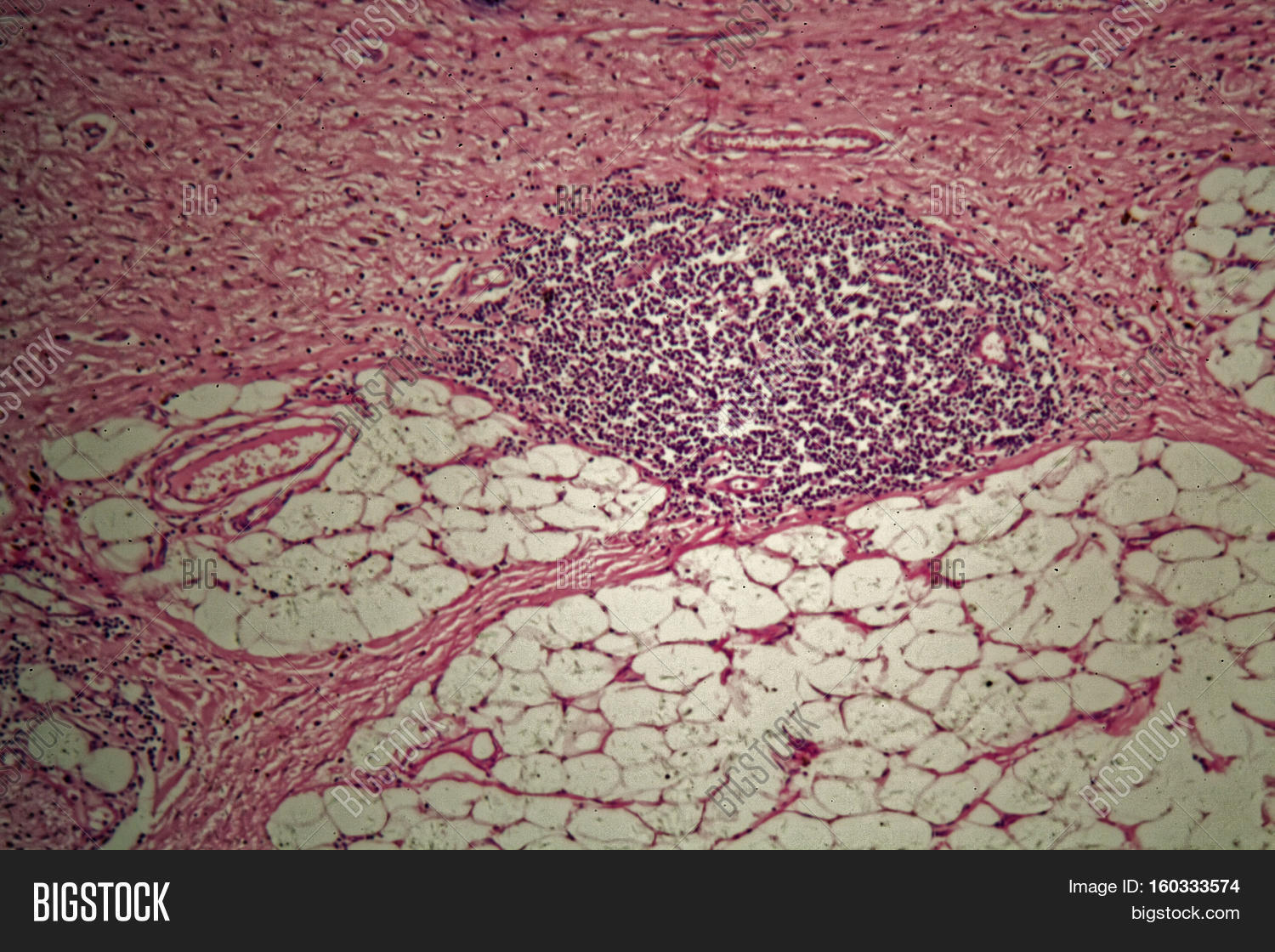 Cells Human Stomach Image & Photo (Free Trial) | Bigstock