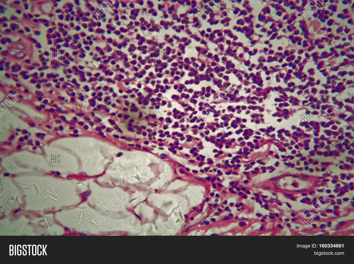 Cells Human Stomach Image & Photo (Free Trial) | Bigstock
