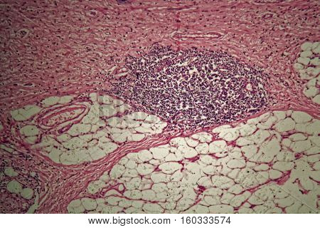 Cells Human Stomach Image & Photo (Free Trial) | Bigstock