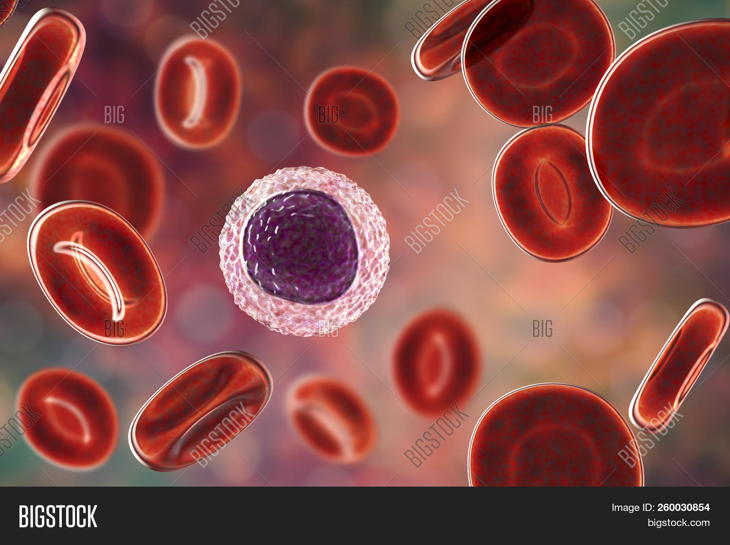 Lymphocyte Surrounded Image & Photo (Free Trial) | Bigstock