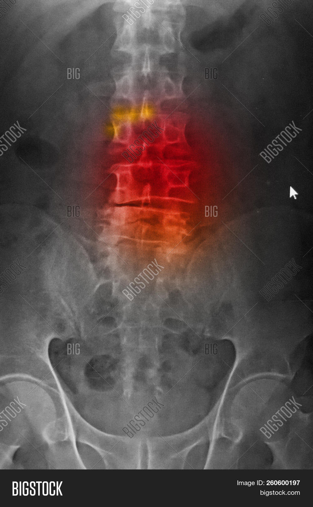 Computed Radiography ( Image & Photo (Free Trial) | Bigstock