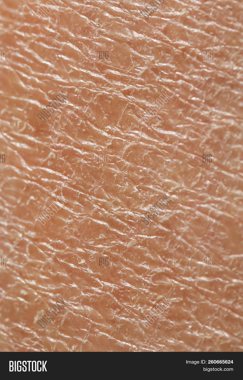 Human Skin Texture Image & Photo (Free Trial) | Bigstock