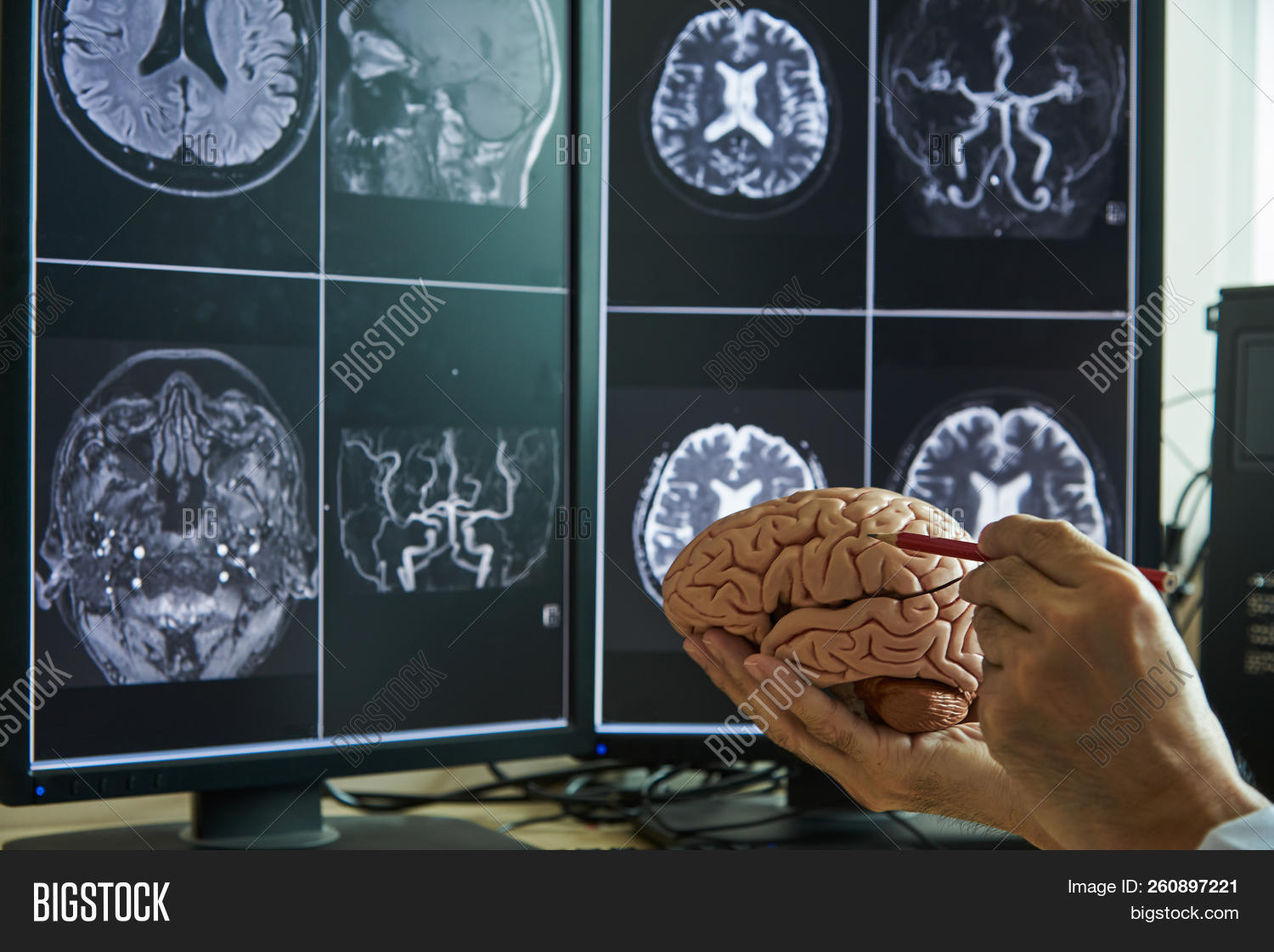 Human Brain Model On Image & Photo (Free Trial) | Bigstock
