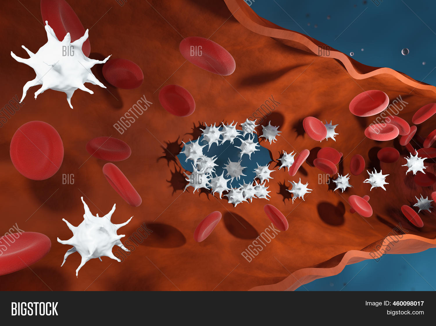 Platelets Repair Wound Image & Photo (Free Trial) | Bigstock
