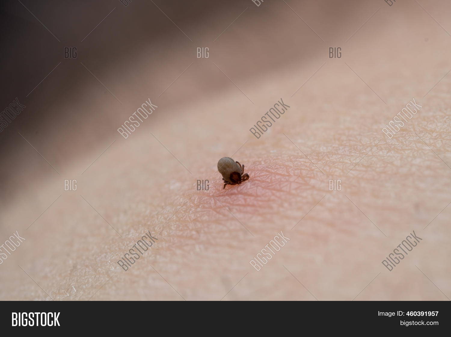 Sucking Tick Macro Image & Photo (Free Trial) | Bigstock