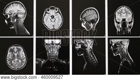 Tomography. Mri Scans Image & Photo (Free Trial) | Bigstock