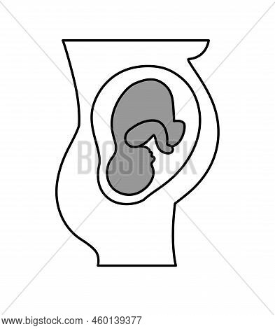 Placental Previa. Vector & Photo (Free Trial) | Bigstock