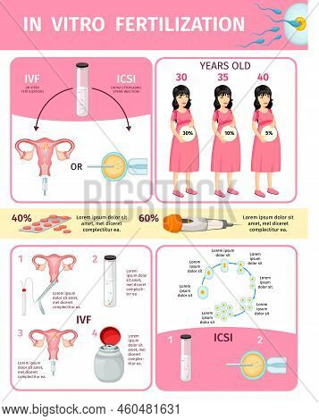 Vitro Fertilization Vector & Photo (Free Trial) | Bigstock