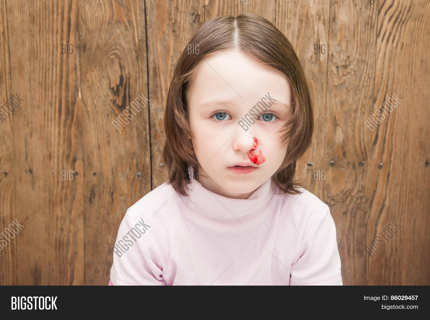 Girl Bleeding Nose Image & Photo (Free Trial) | Bigstock