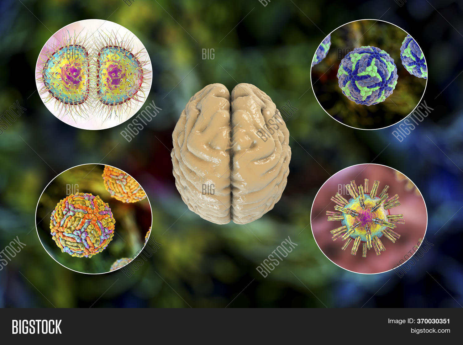 Brain Infections, Image & Photo (Free Trial) | Bigstock