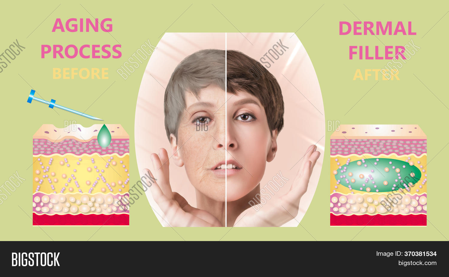 Cosmetic Dermal Image & Photo (Free Trial) | Bigstock
