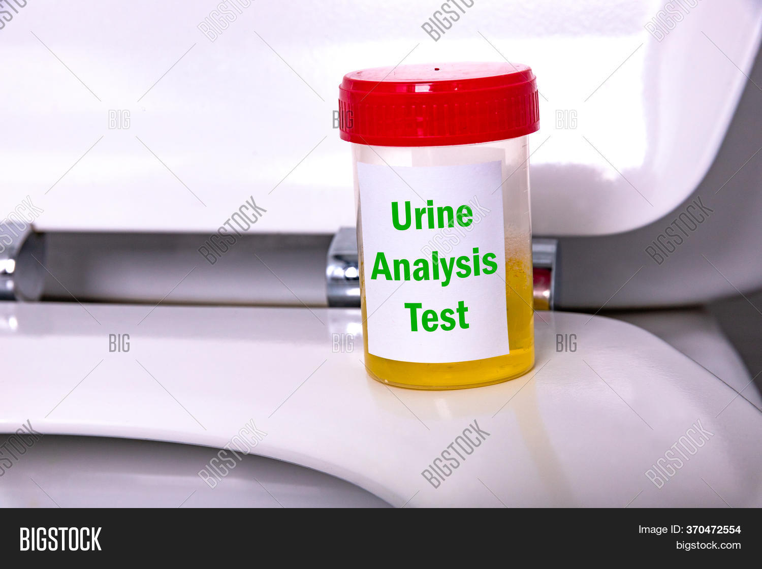 Yellow Urine Sample Image & Photo (Free Trial) | Bigstock