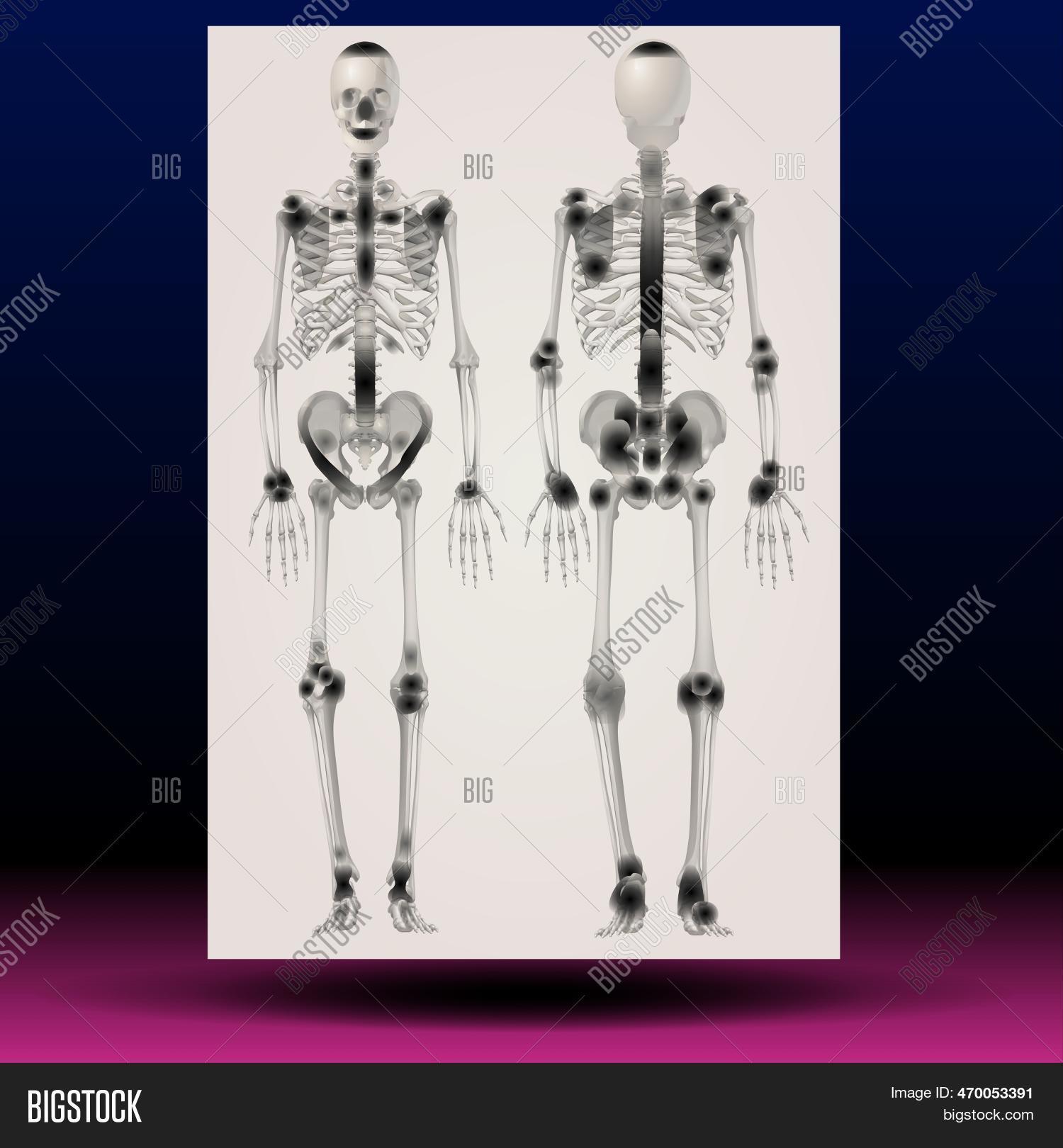 X-ray Illustration Image & Photo (Free Trial) | Bigstock