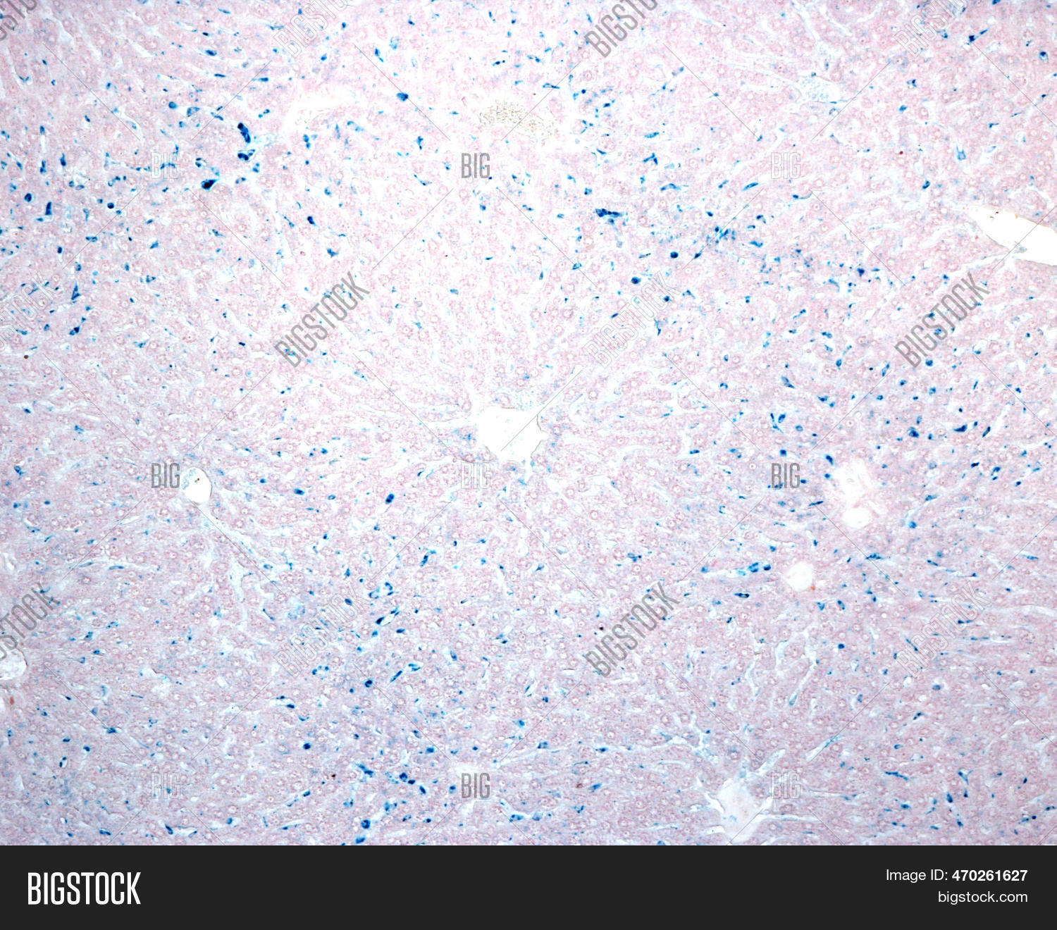 Liver. Kupffer Cells Image & Photo (Free Trial) | Bigstock